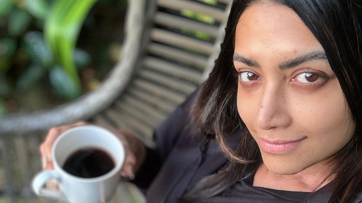 Jana Gana Mana actress Mamta Mohandas diagnosed with vitiligo, fans ...