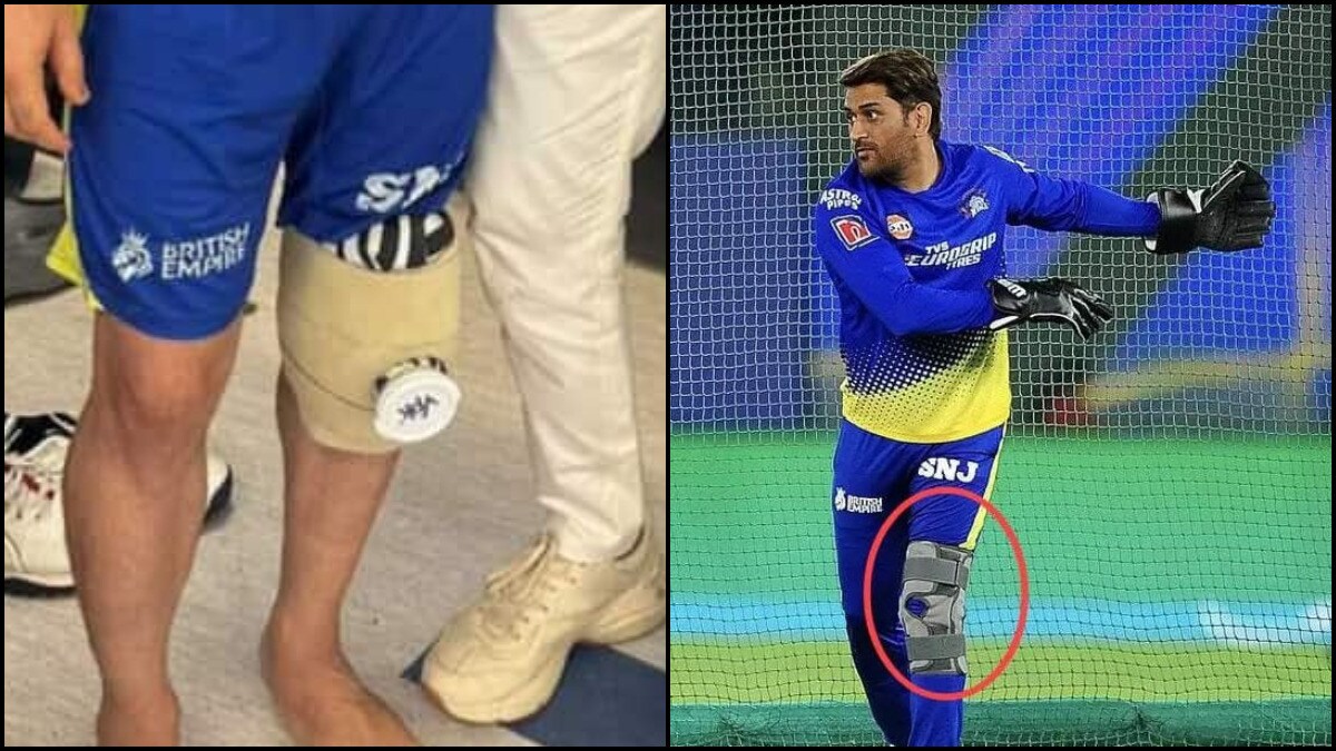 As CSK skipper MS Dhoni undergoes successfully knee surgery, fans wish ...