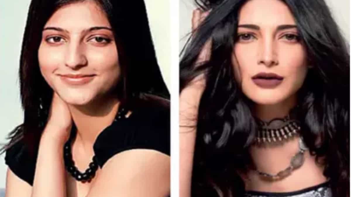 Shruti Haasan Unapologetically Confesses To Nose Job I Dont Feel The